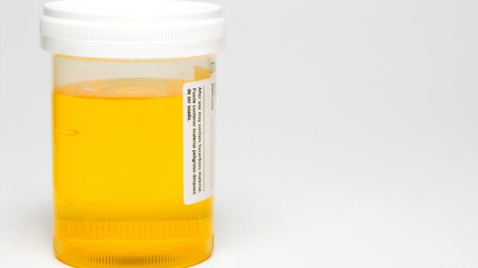 Därför är urinprovet så viktigt | Bebisvarlden.se